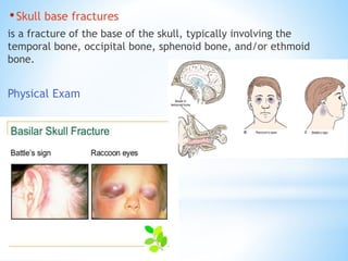 Concussions Skull Fractures Intracranial Hematoma Lesson 3 Health ...