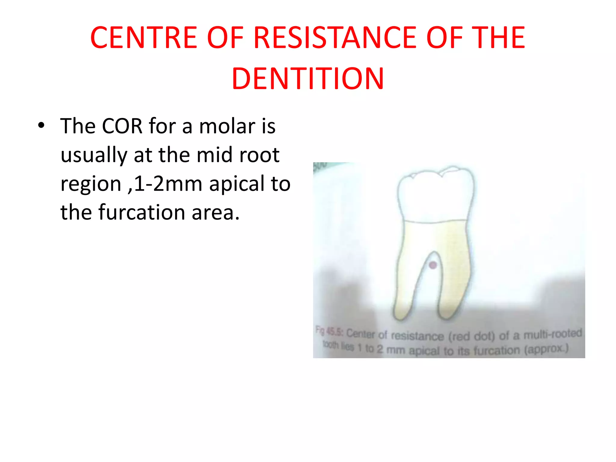 Head gear in orthodontics | PPTX