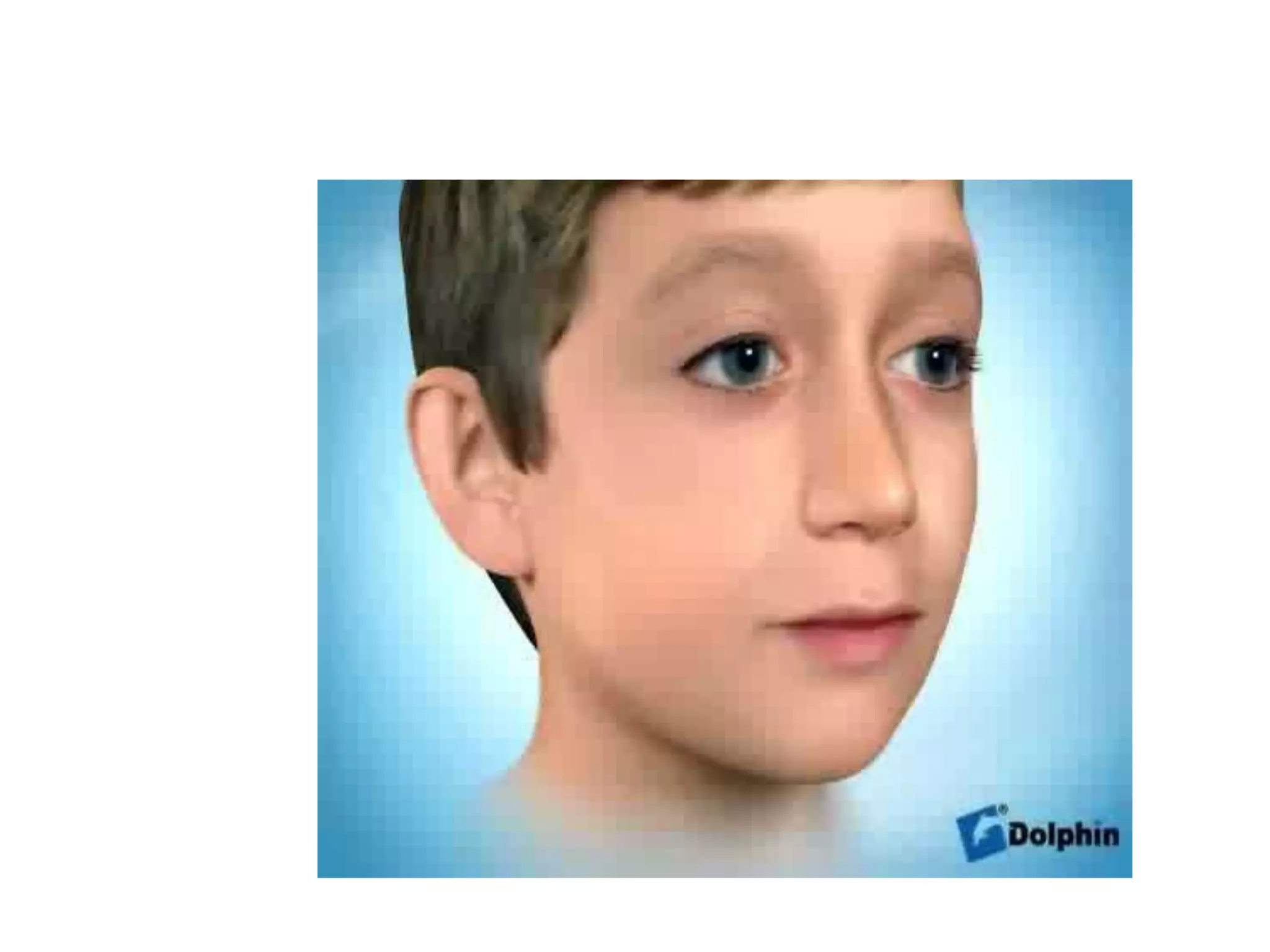 Head gear in orthodontics | PPTX