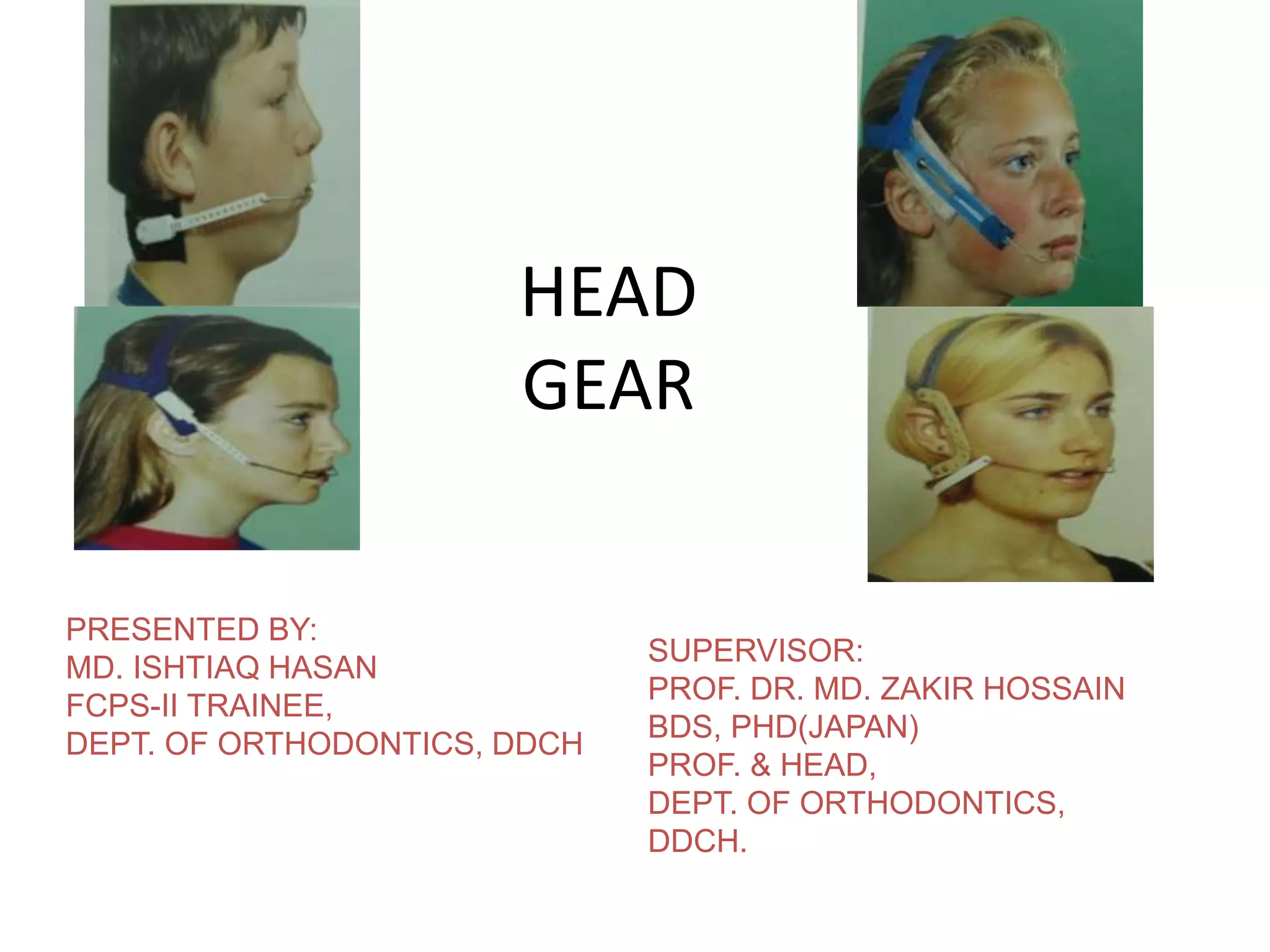 Head gear in orthodontics | PPTX