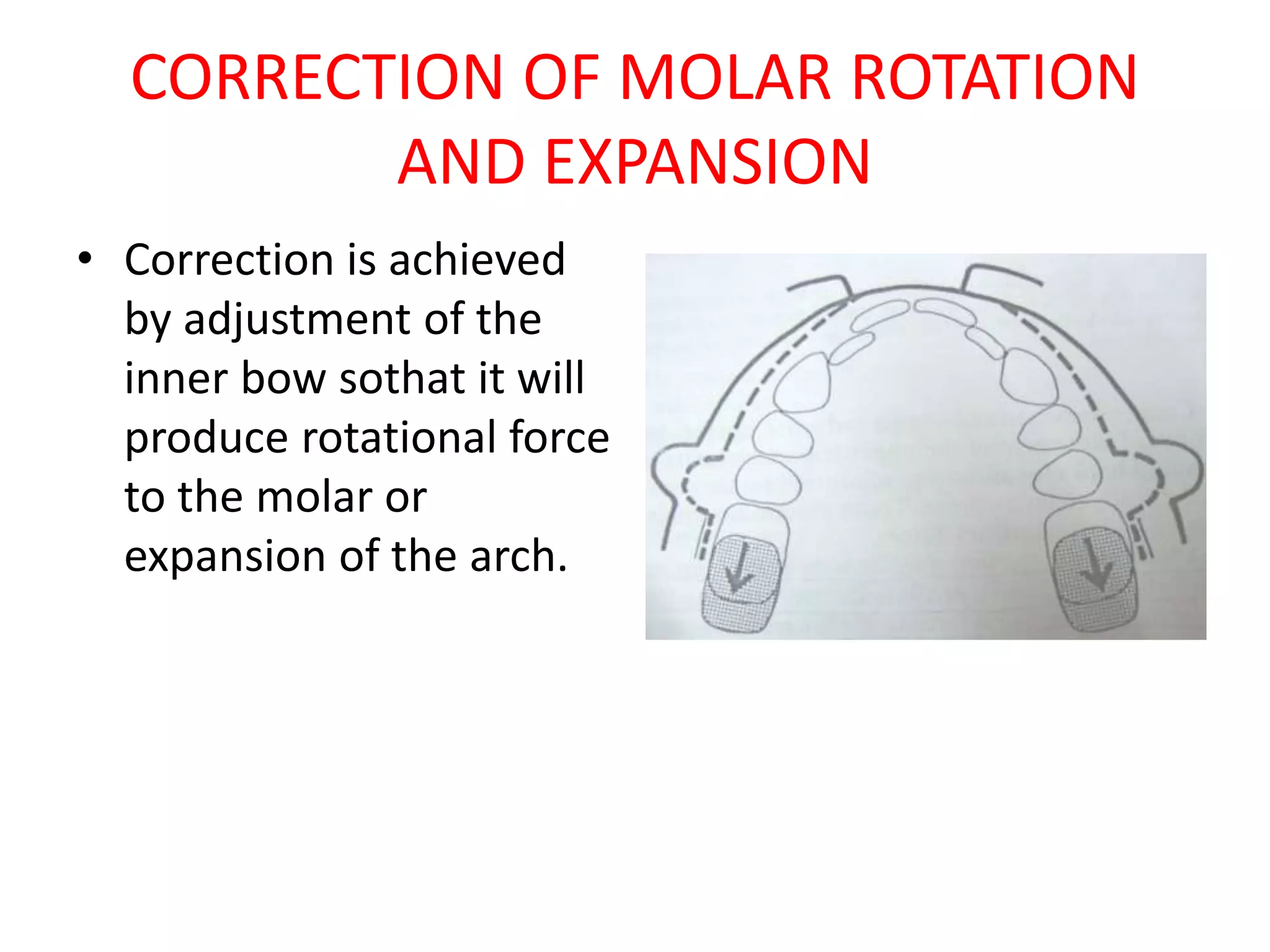 Head gear in orthodontics | PPTX