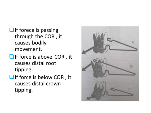 Head gear in orthodontics | PPTX | Oral care | Personal Care