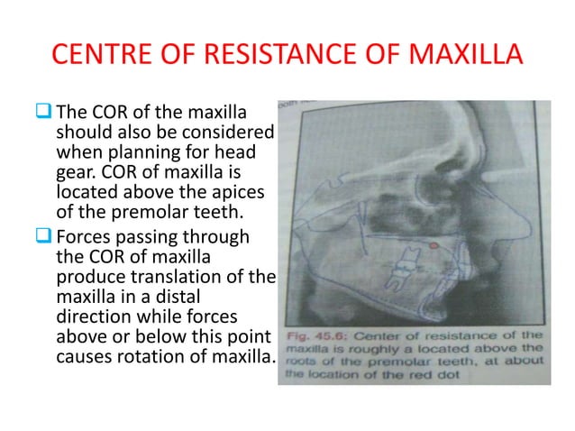 Head gear in orthodontics | PPTX | Oral care | Personal Care