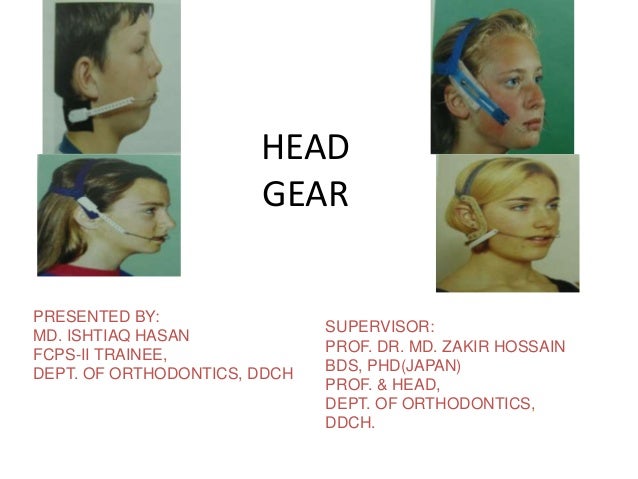 Headgear Orthodontics Slideshare