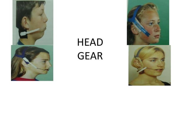 headgear.pptx