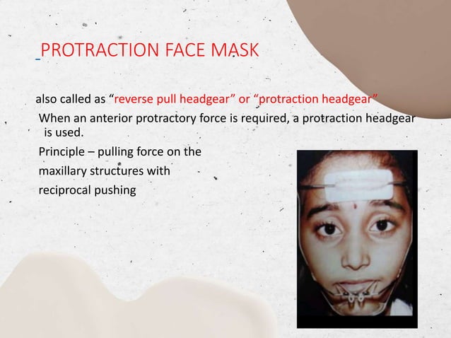 HEADGEAR and FACE MASK ORTHOPEDIC FORCE .pptx | Dental Health | Diseases and Conditions