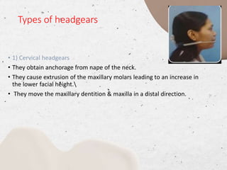 HEADGEAR and FACE MASK ORTHOPEDIC FORCE .pptx