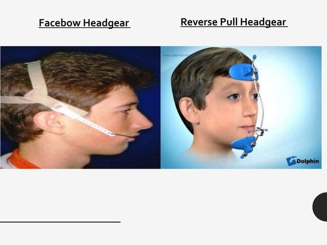 Headgear | PPTX