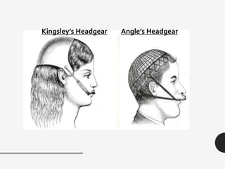 Headgear | PPT