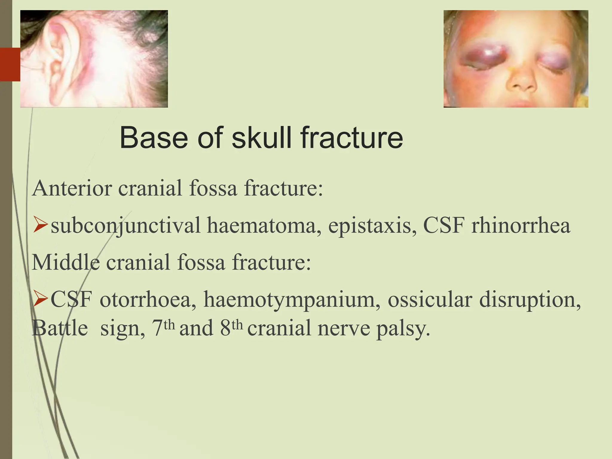 headinjuries - types, causes, management | PPT | Death, Injury, or ...