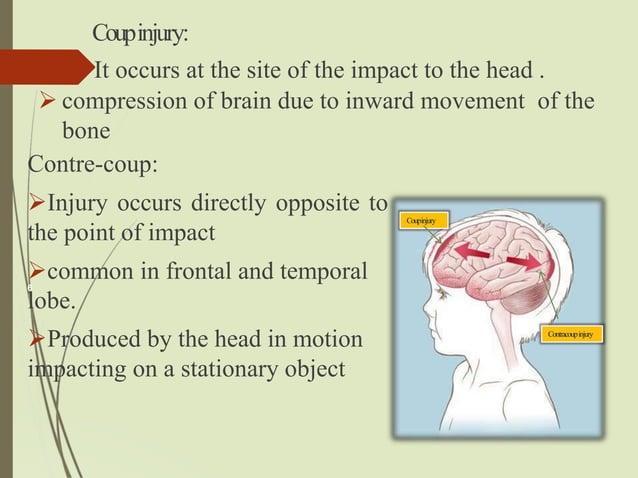 headinjuries - types, causes, management | PPT