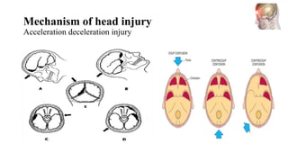 Head injuries | PPTX