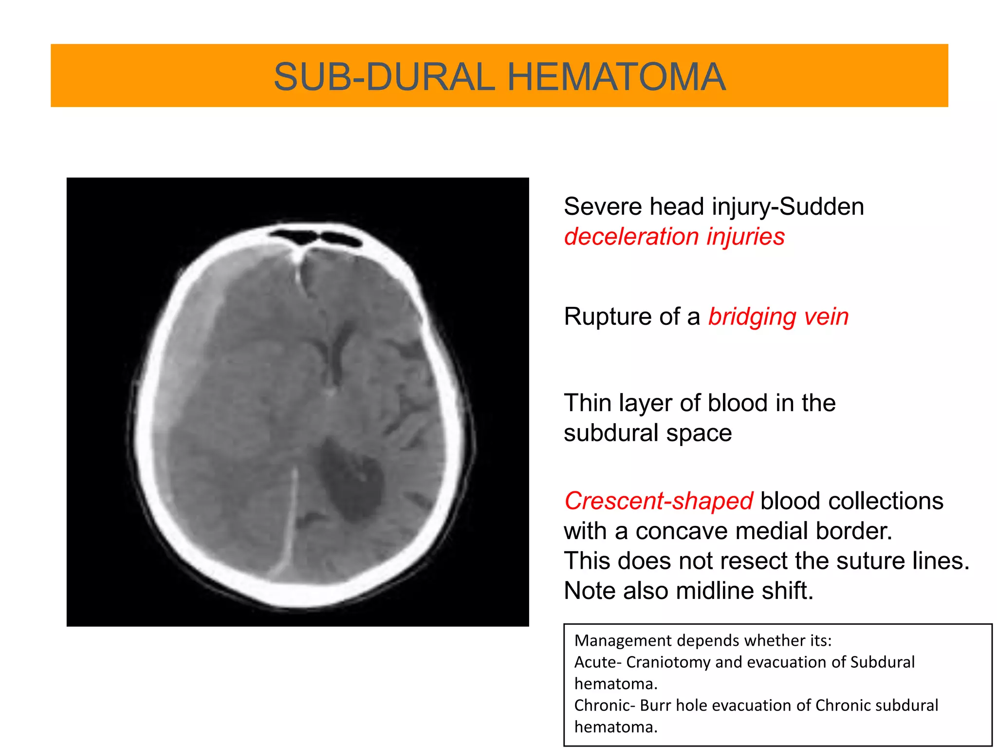 Traumatic brain Injury | PPT
