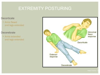 Abnormal Posturing Brain Injury