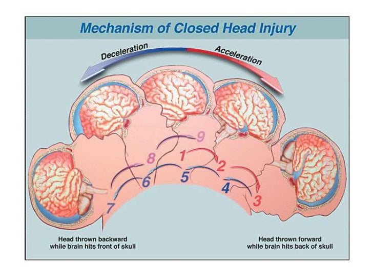 surgery.Head injury.(dr.ari)