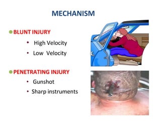 headinjury-150117141638-conversion-gate02.pptx