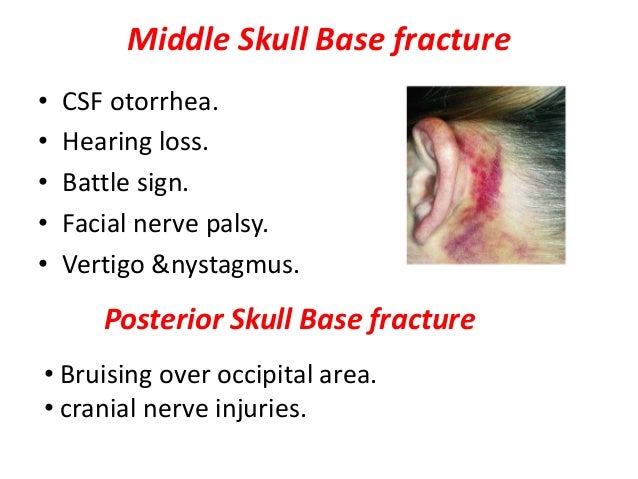Head injury Mohammed Hasanin
