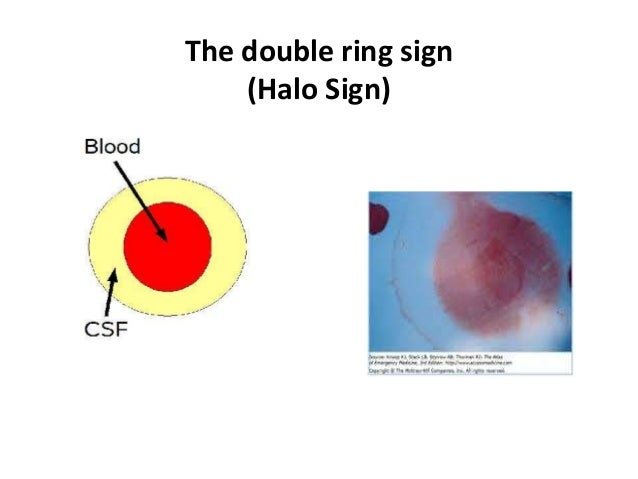 Head injury Mohammed Hasanin