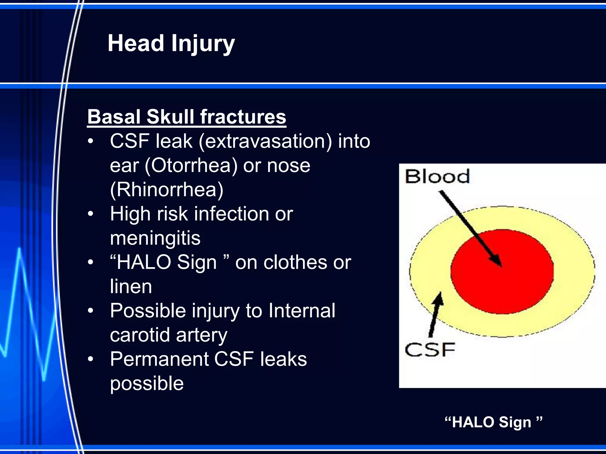 Head injury | PDF
