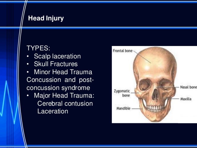 Head injury