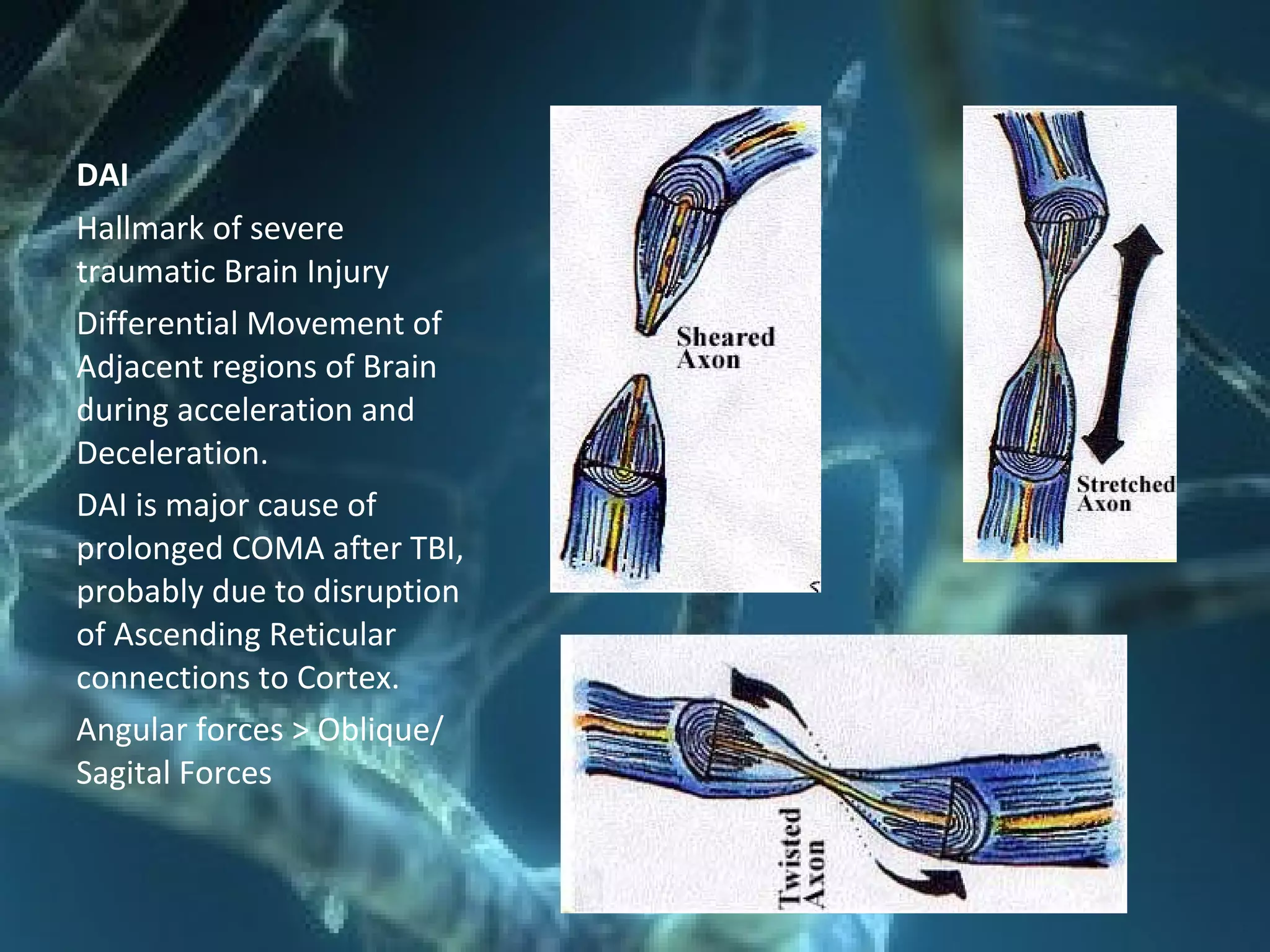 Head Injury | PPT