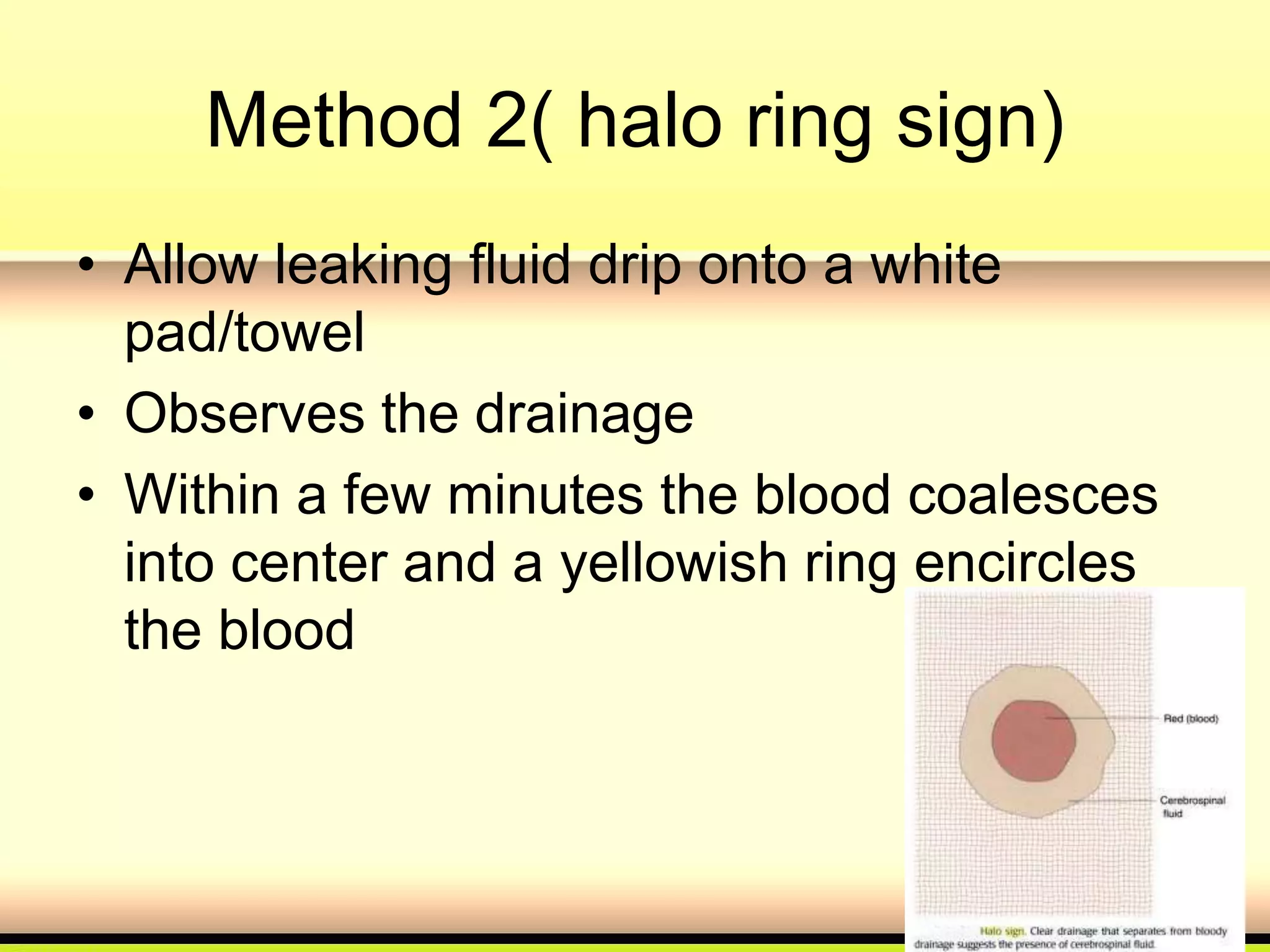 Head injury.ppt