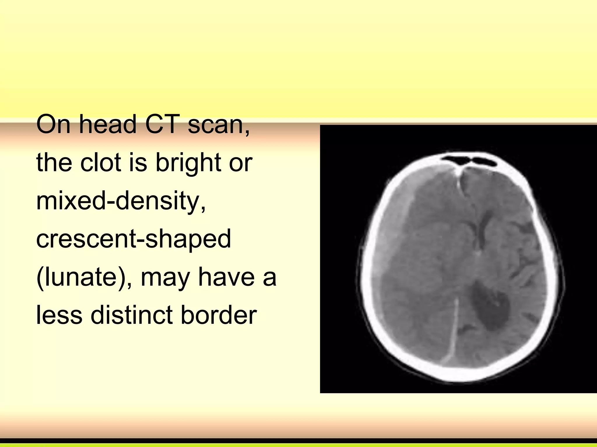 Head injury.ppt