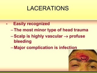 Cranial Laceration