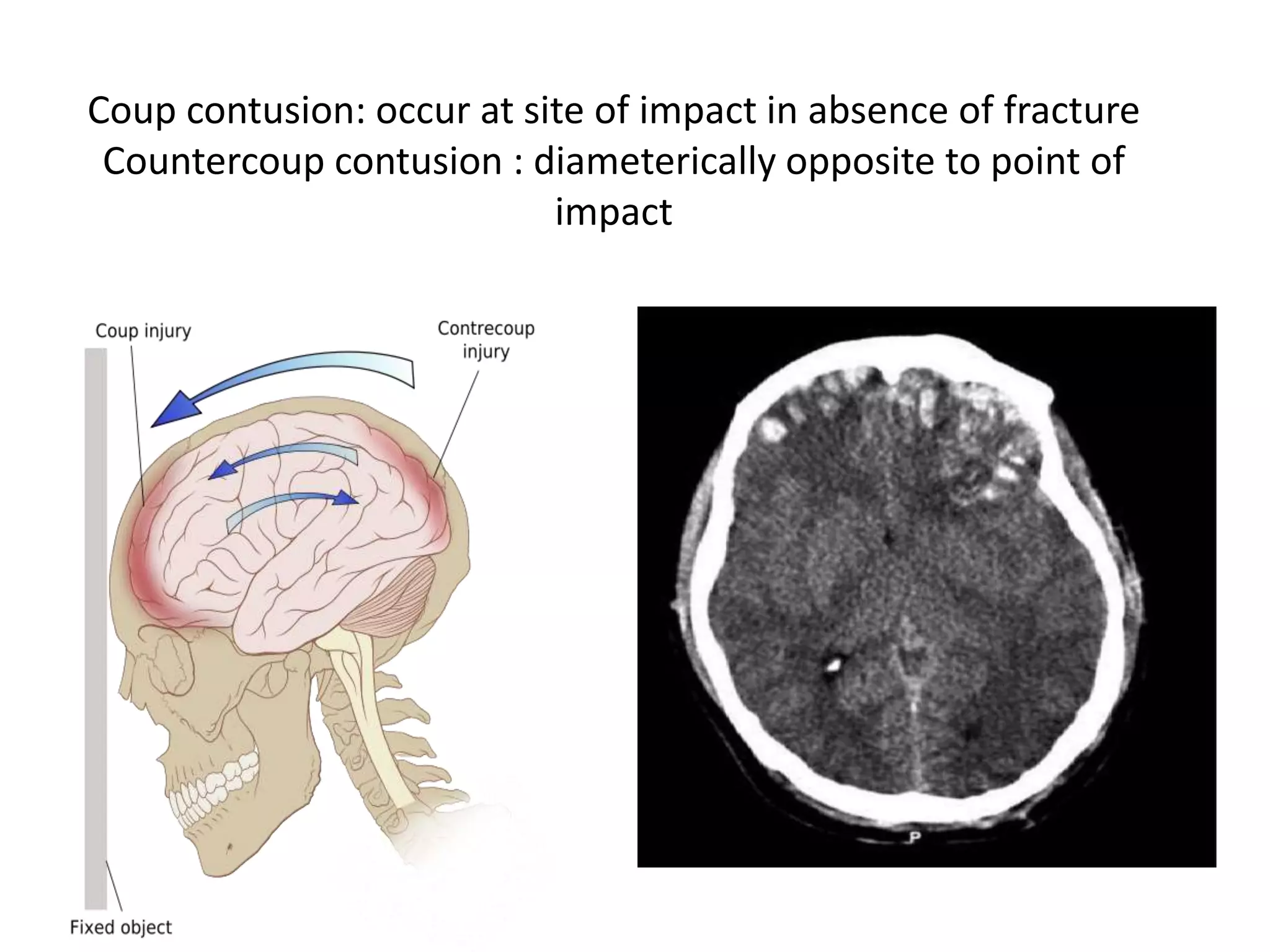 Head injury( Diagnosis/symptoms/investigation/Treatment) | PPTX