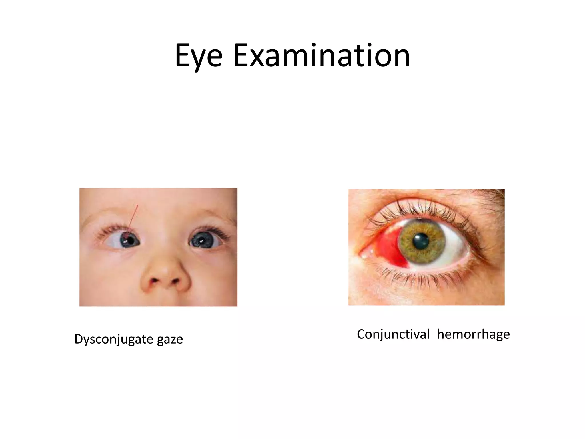 Head injury( Diagnosis/symptoms/investigation/Treatment) | PPTX