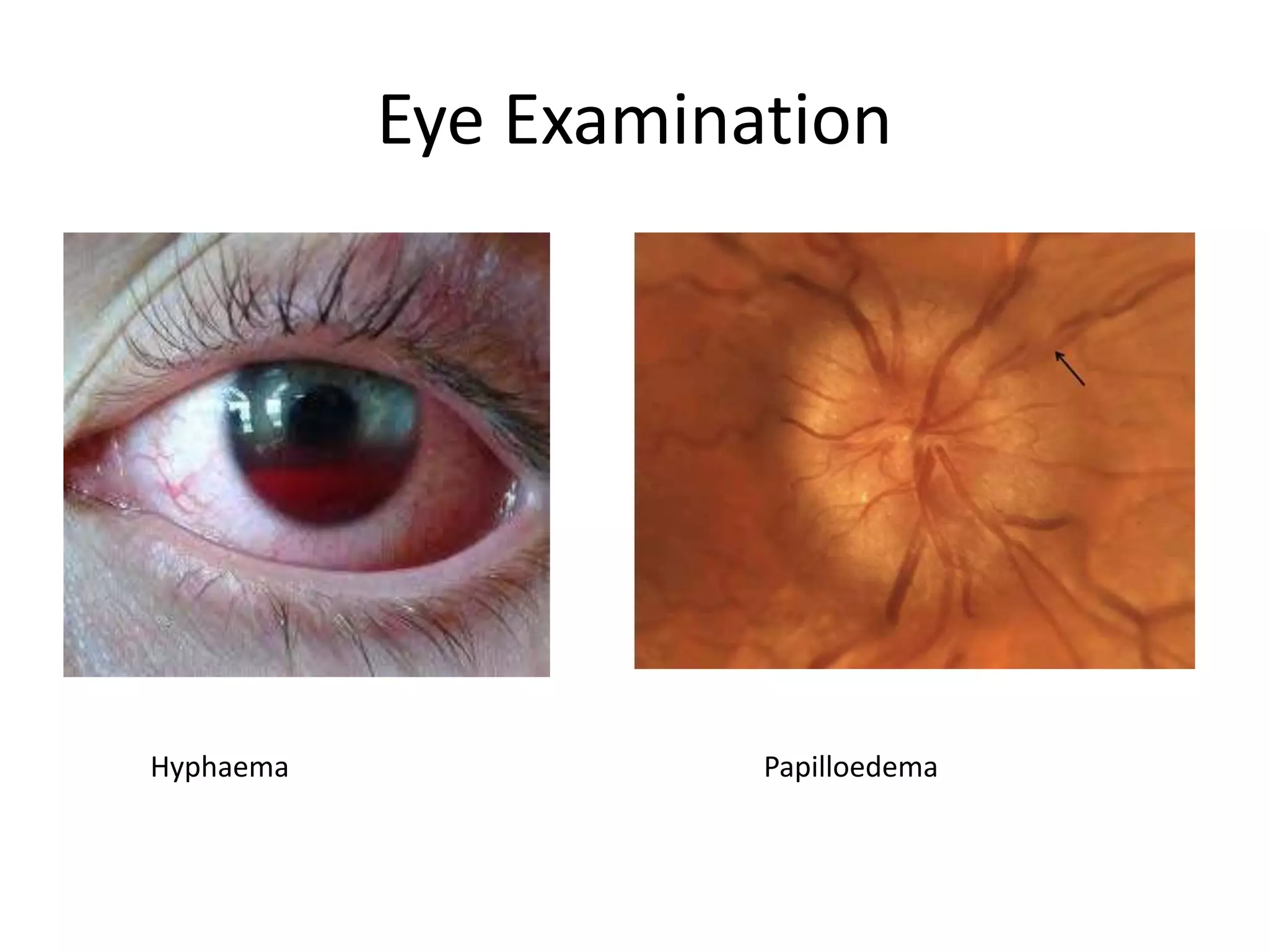 Head injury( Diagnosis/symptoms/investigation/Treatment) | PPTX