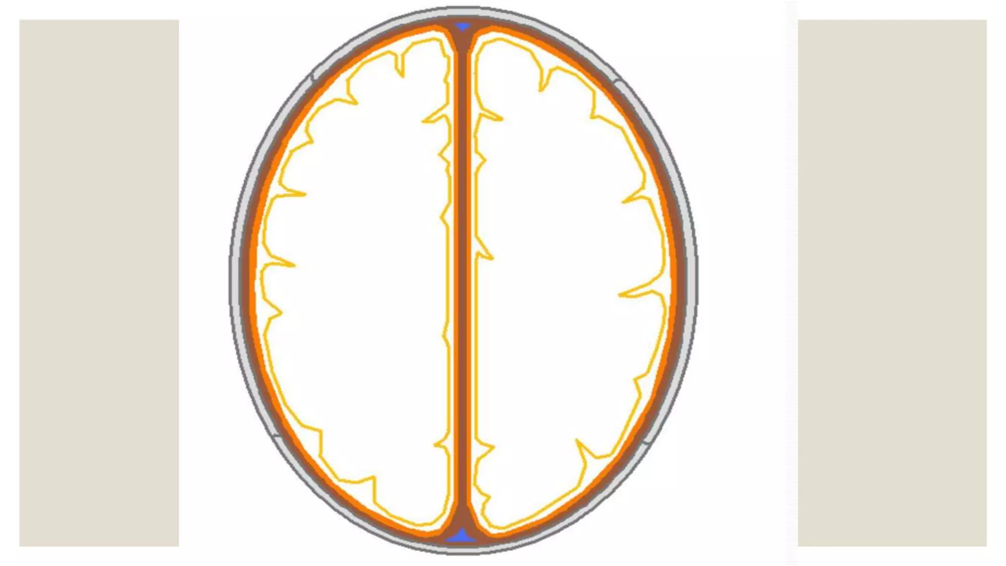 Primary and secondary head injury EDH and SDH | PPTX