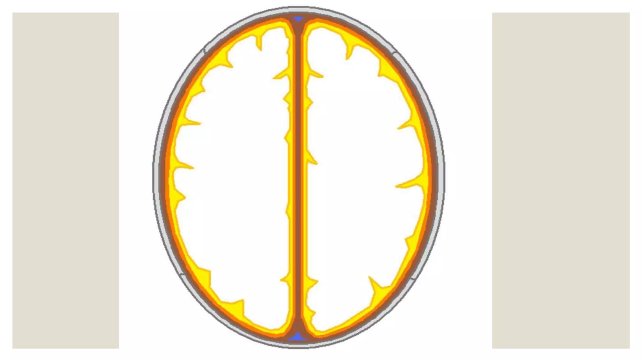 Primary and secondary head injury EDH and SDH | PPTX