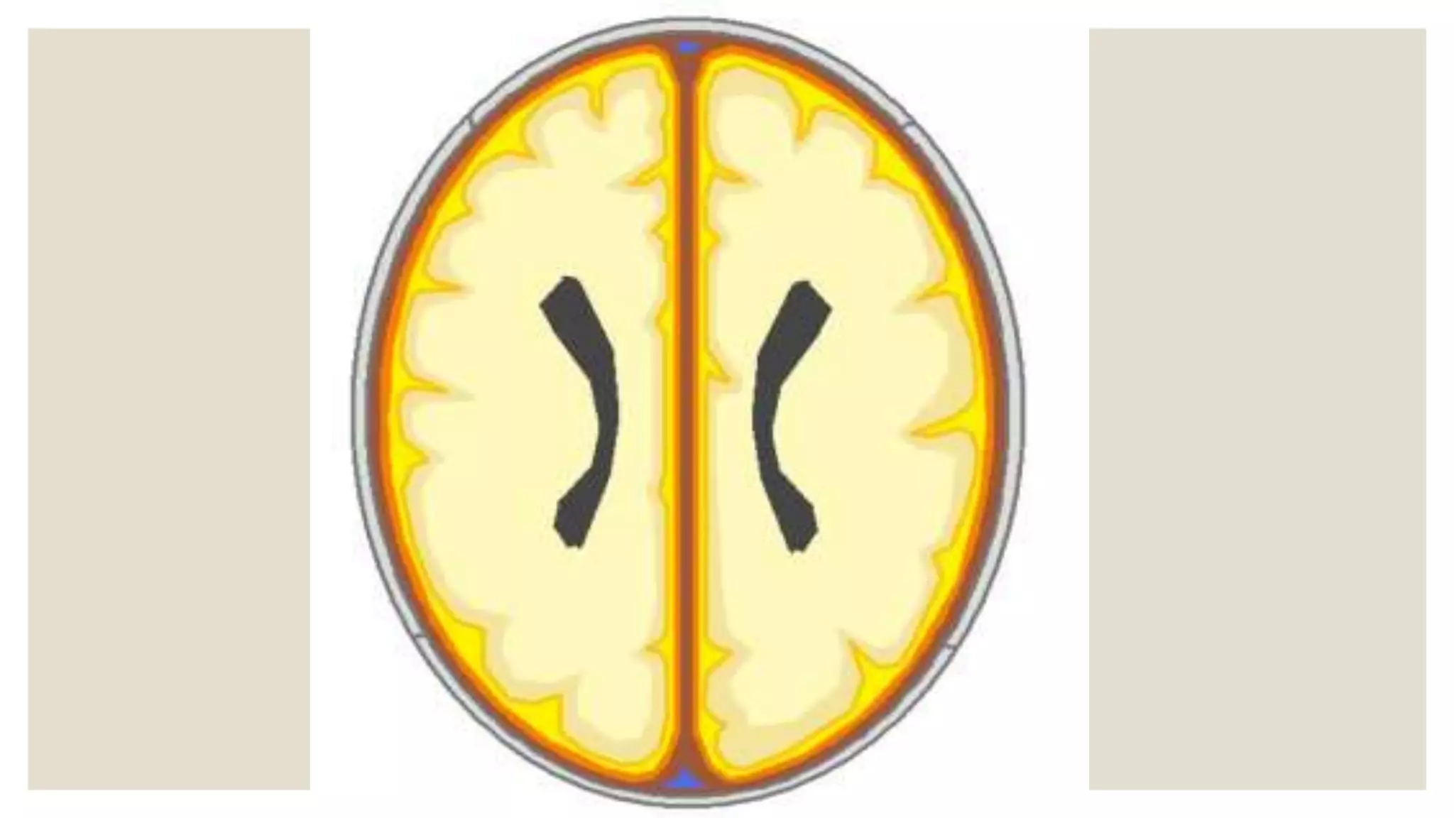 Primary and secondary head injury EDH and SDH | PPTX