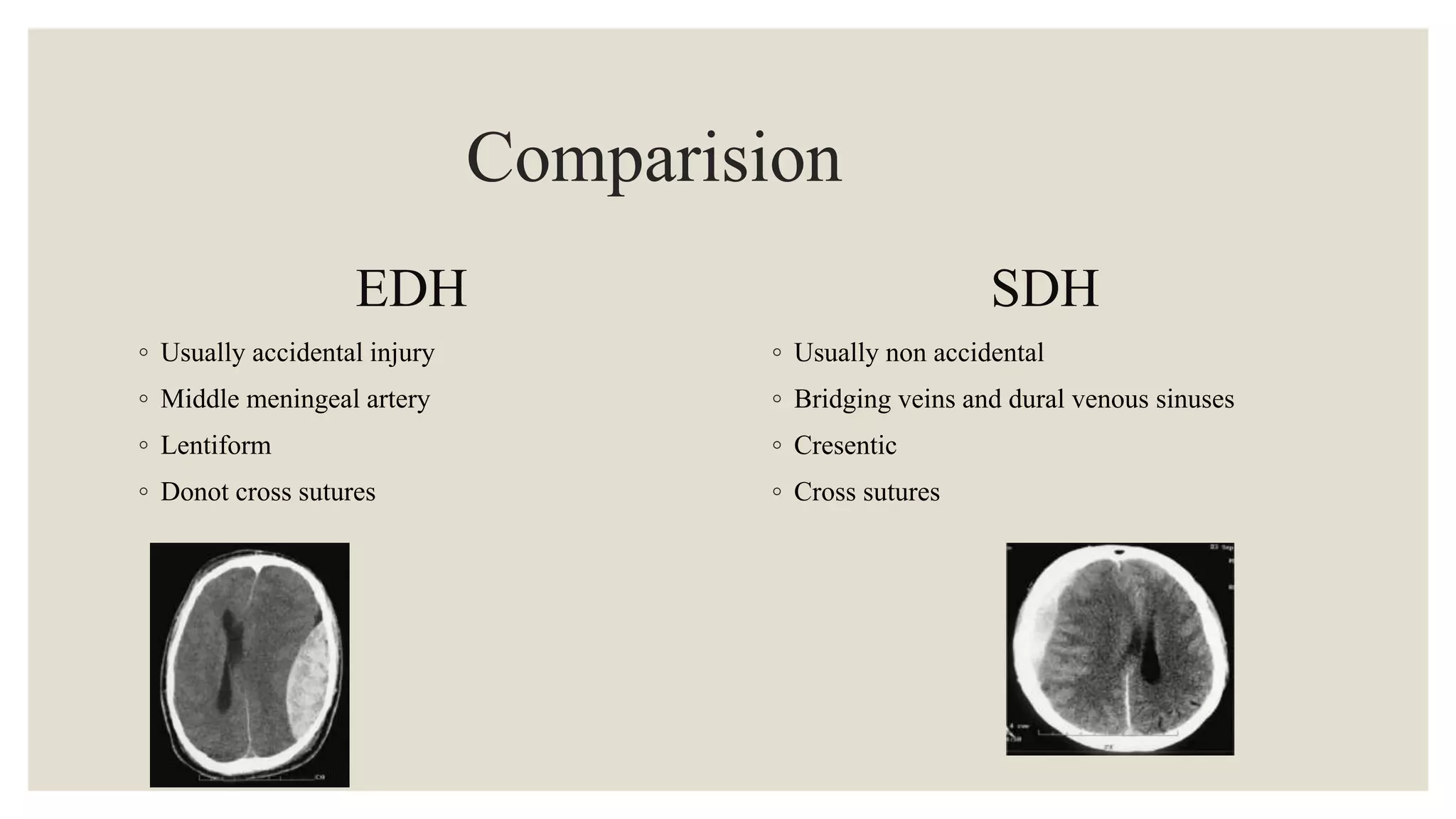 Primary and secondary head injury EDH and SDH | PPTX