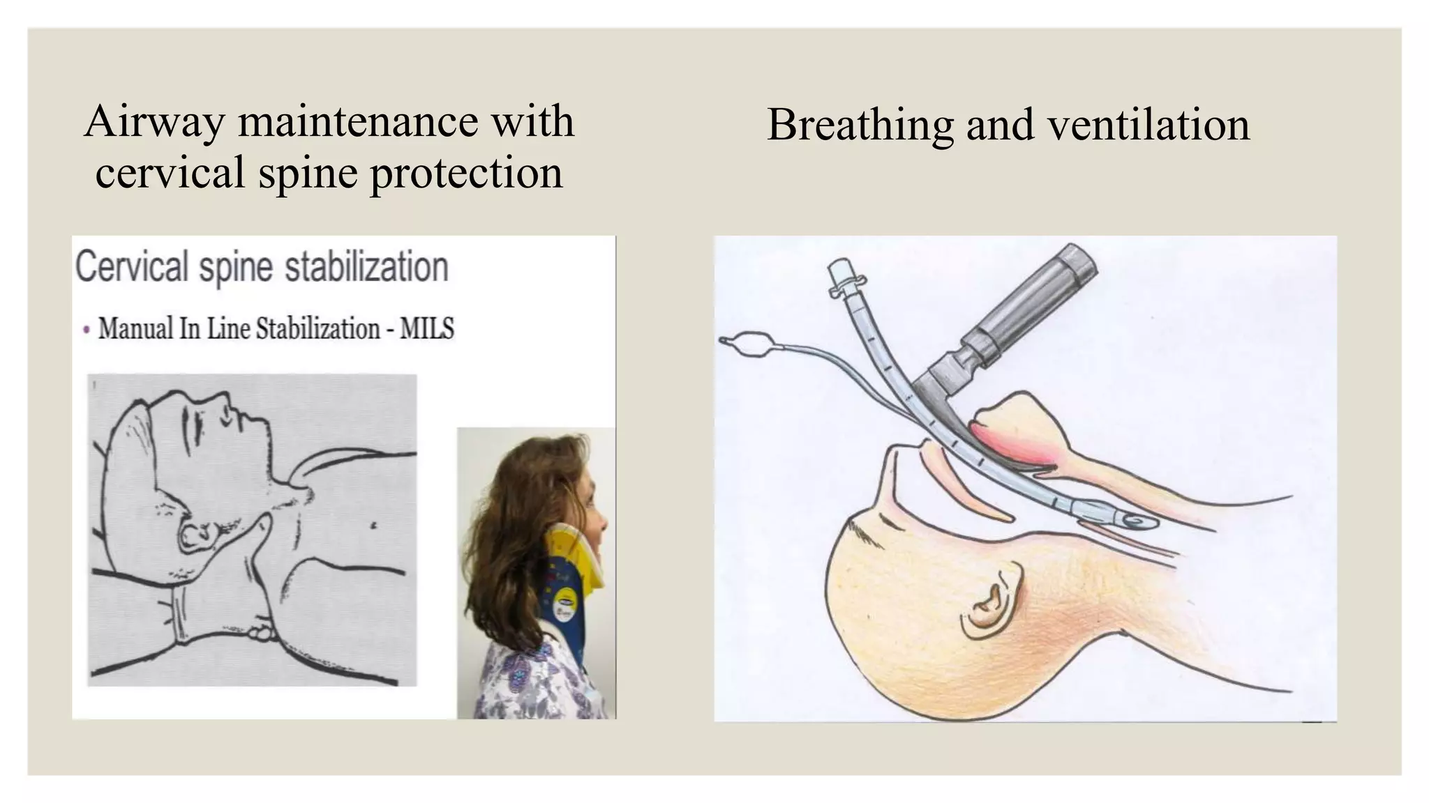 Primary and secondary head injury EDH and SDH | PPTX