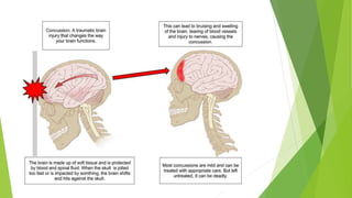 Head injury | PPTX