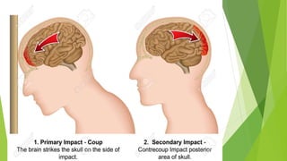 Head injury | PPTX