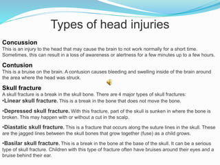 Head injury | PPTX
