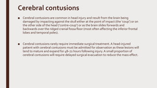 Head Injury | PPTX