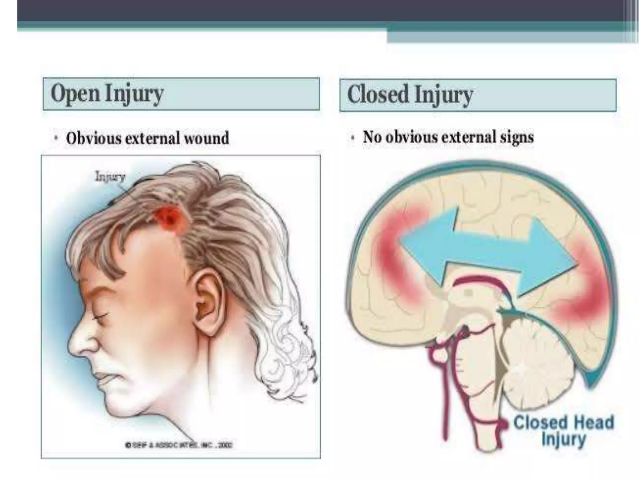 Head injury med surg presentation | PPTX
