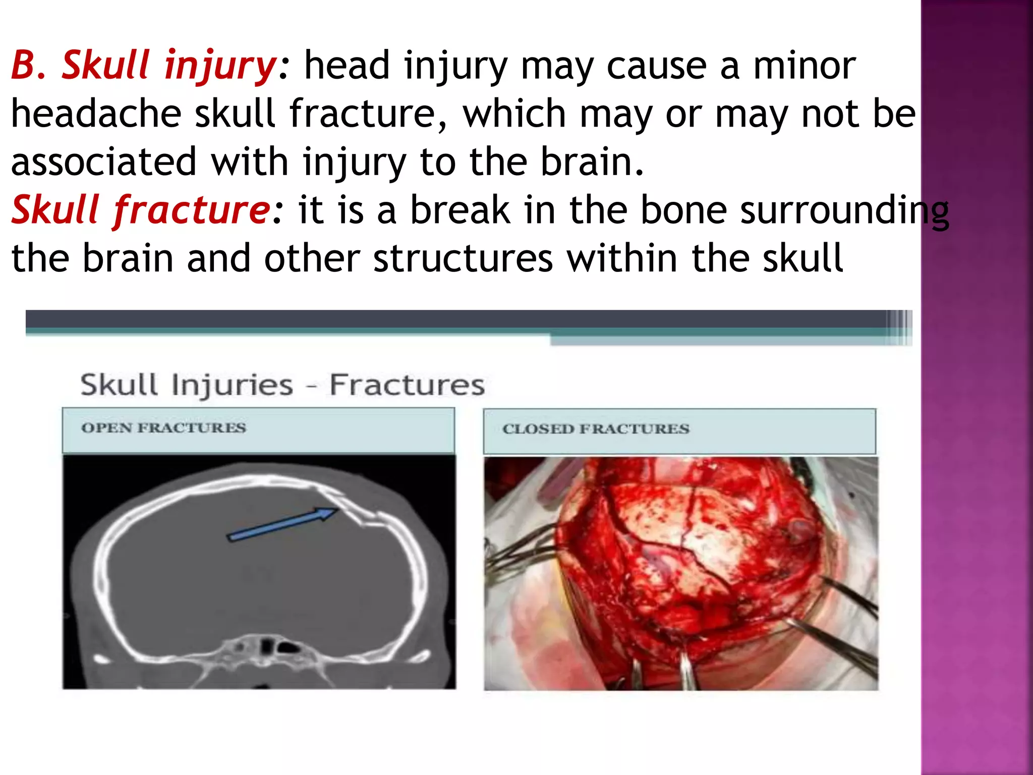 Head injury med surg presentation | PPT