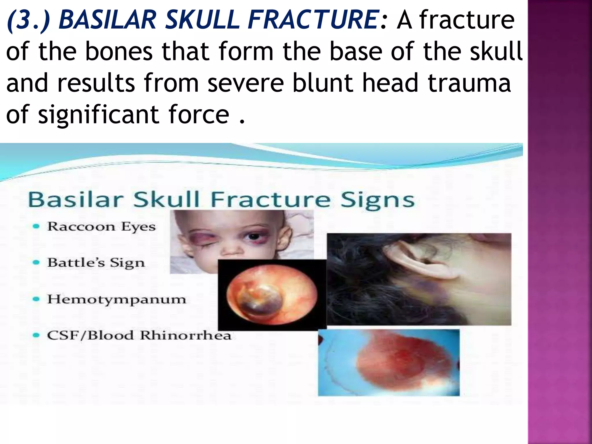 Head injury med surg presentation | PPTX