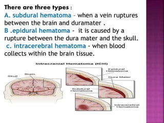 Head injury med surg presentation | PPTX