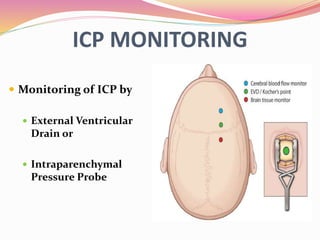 Head injury for Undergraduate Medical Students | PPT