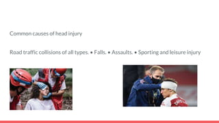 HEAD INJURY.pptx