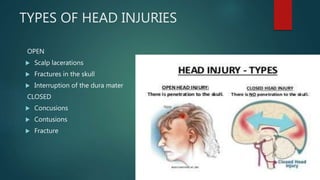 HEAD INJURY.pptx