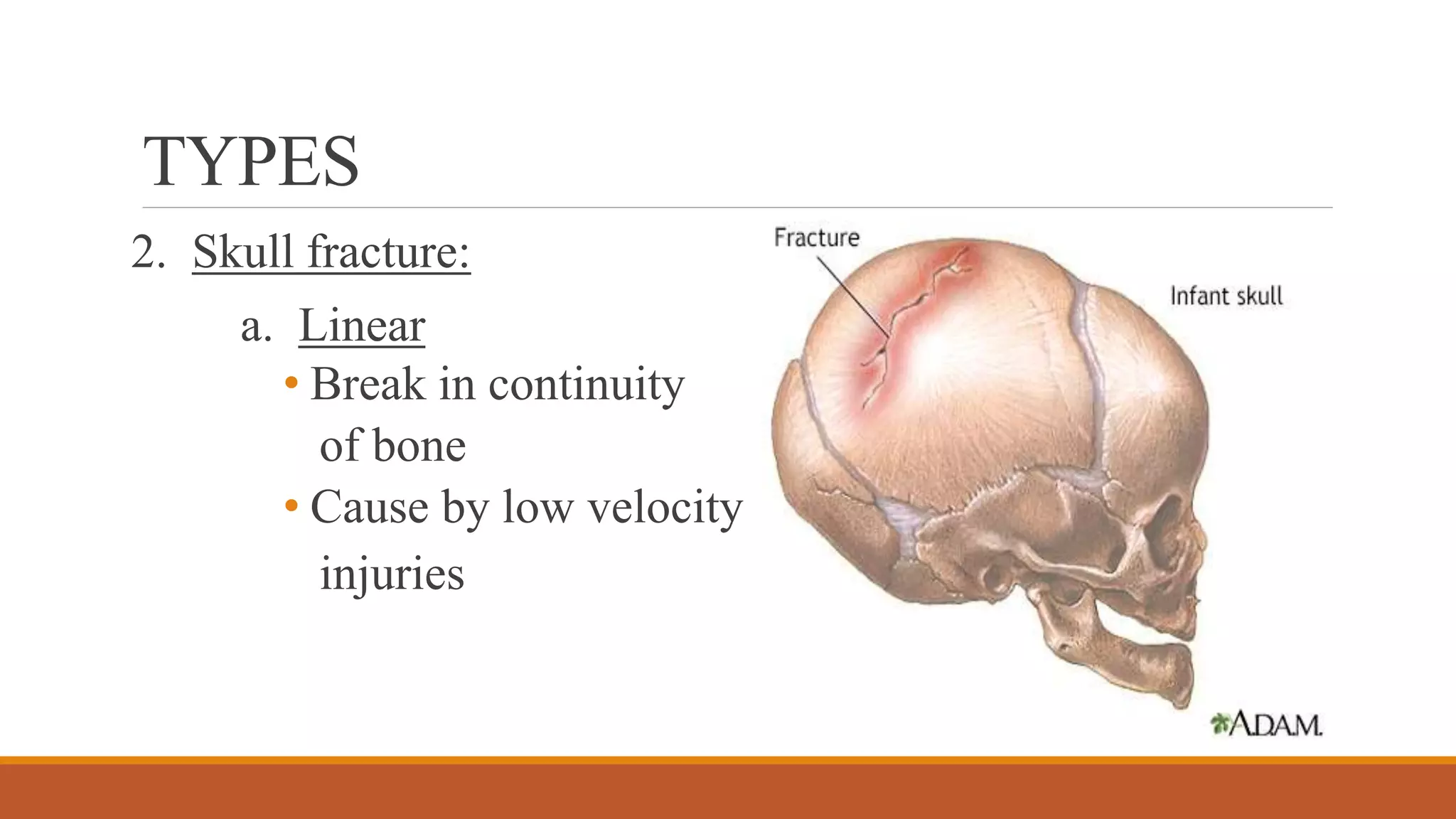 Head injury.pptx | First Aid | Injuries