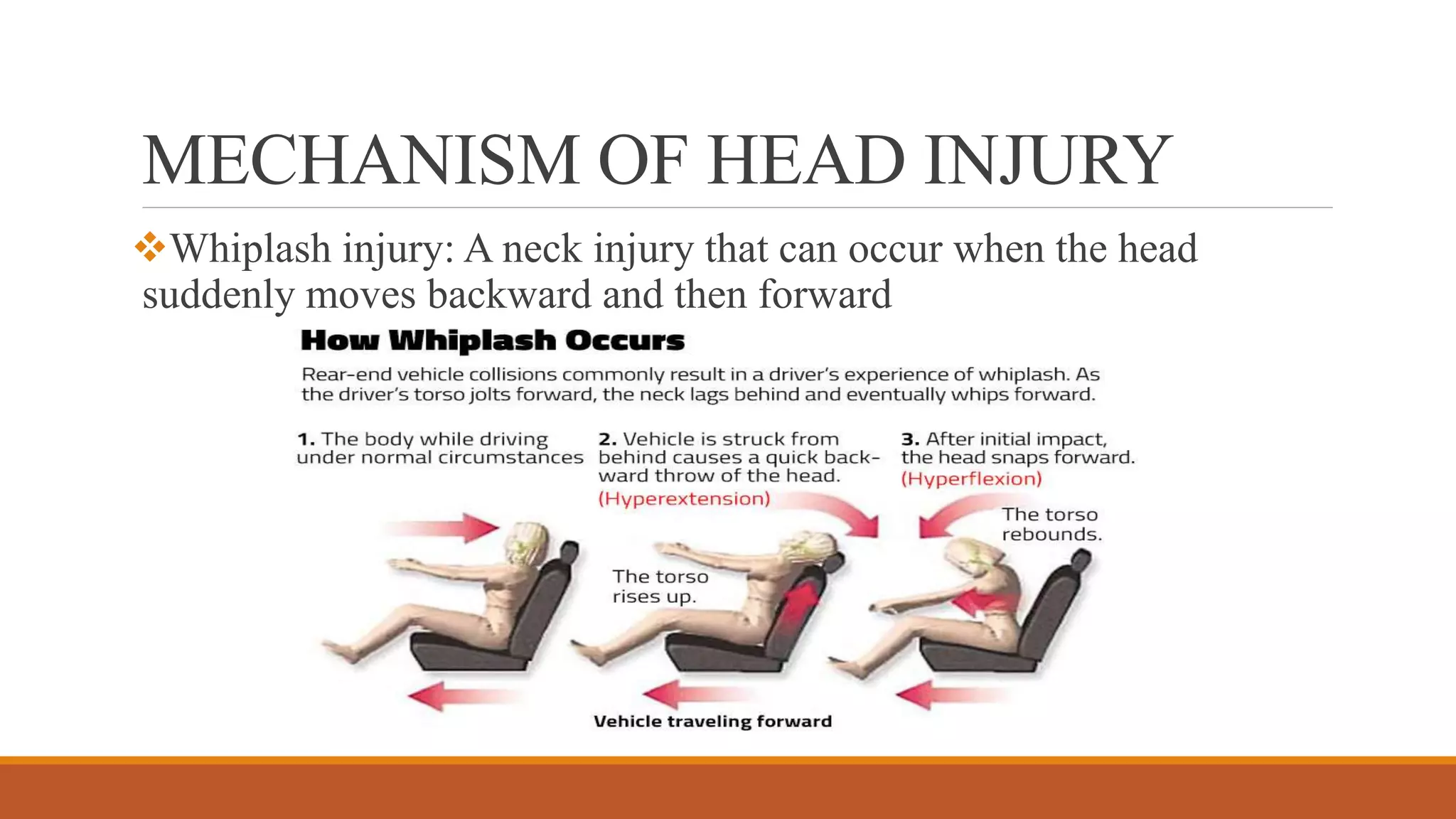 Head injury.pptx