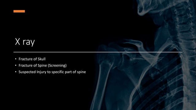 Head Injury.pptx | Free Download